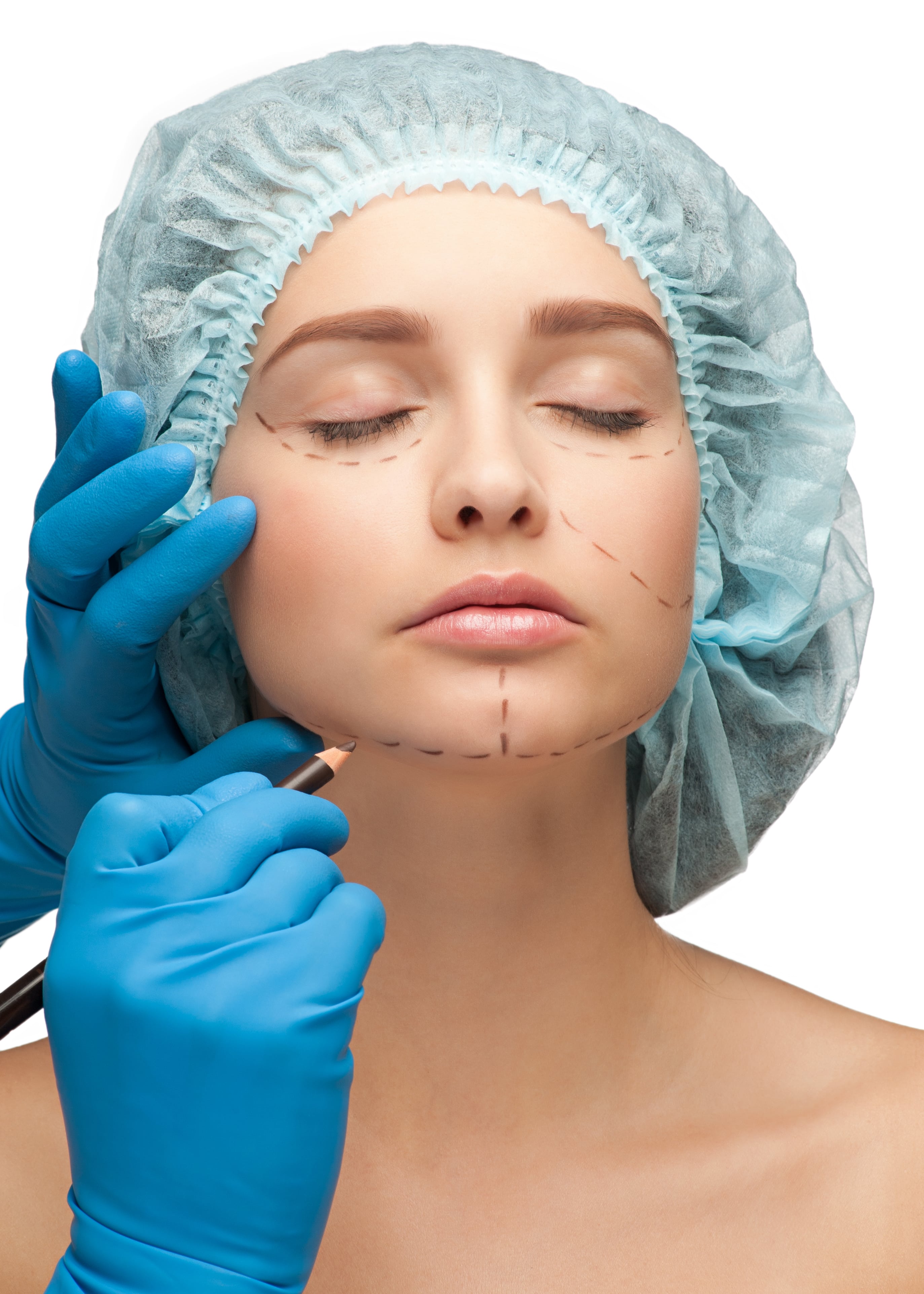 Traitement du menton par injections de botox - Carré Esthétique Lafayette